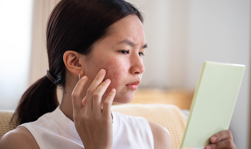 6 Ways That Hormones Affect Your Skin | Atlantic Health